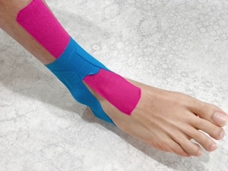 キネシオテーピングとは | COLCHE（コルチェ） 静岡県伊豆・伊東市のトータルビューティーサロン